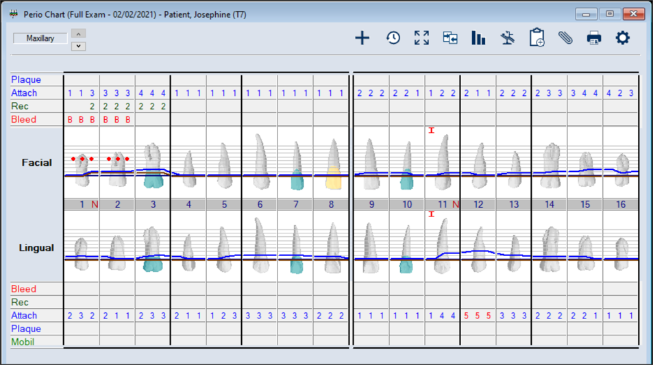 Perio Chart Overview