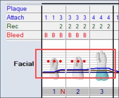 Customize Perio Chart