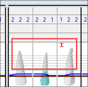 Customize Perio Chart